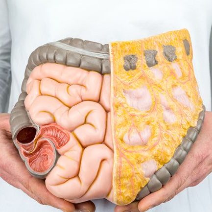 Kolon ve Rektum Kanserinin Evreleri